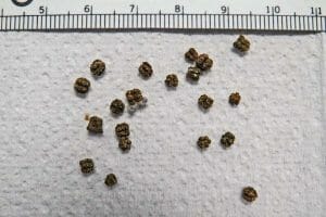 How to Handle the “Poopy Balls” of Life | Take Back Your Temple ...